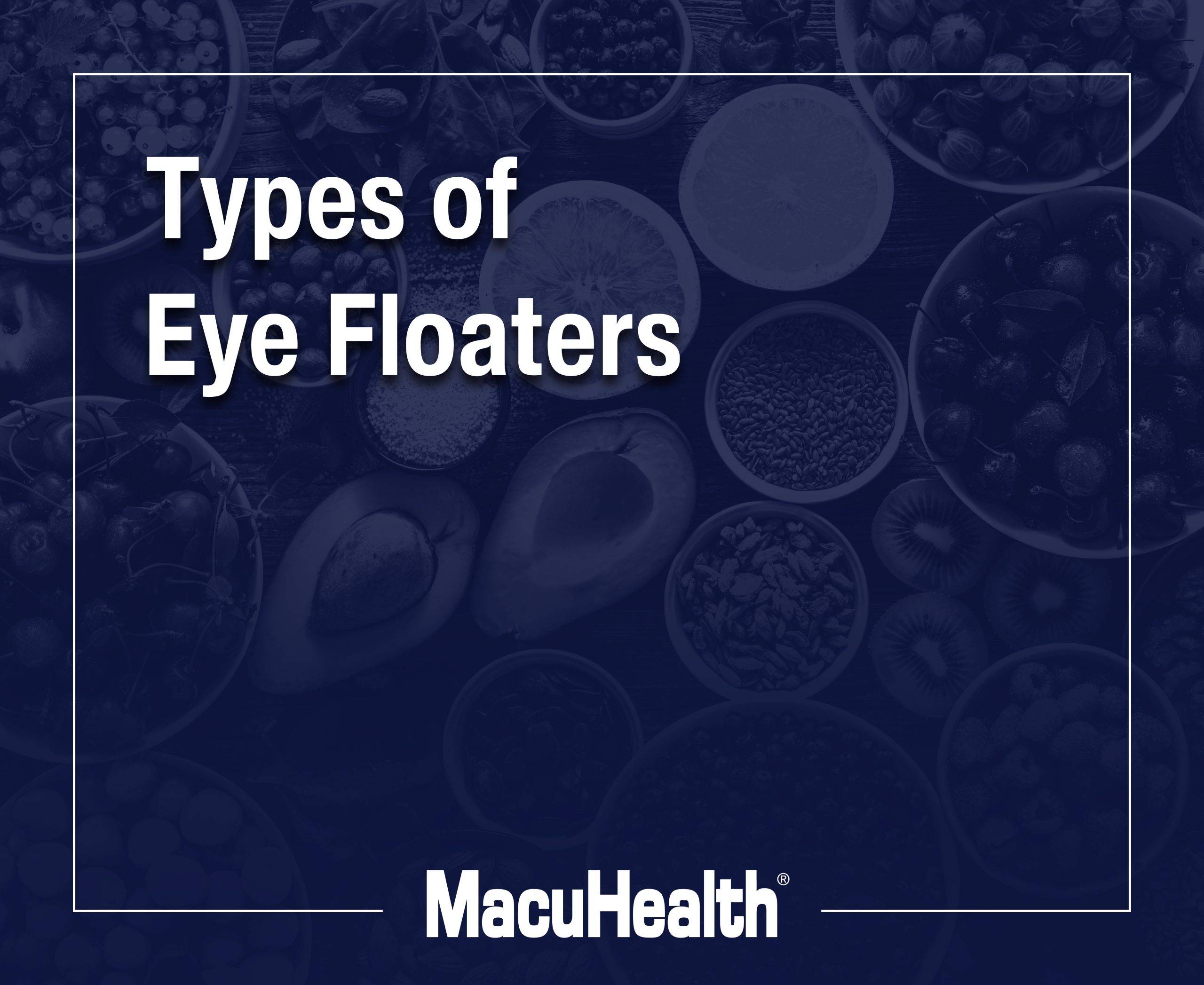 Ocular Floaters Here Are The Most Common Types Of Eye Floaters